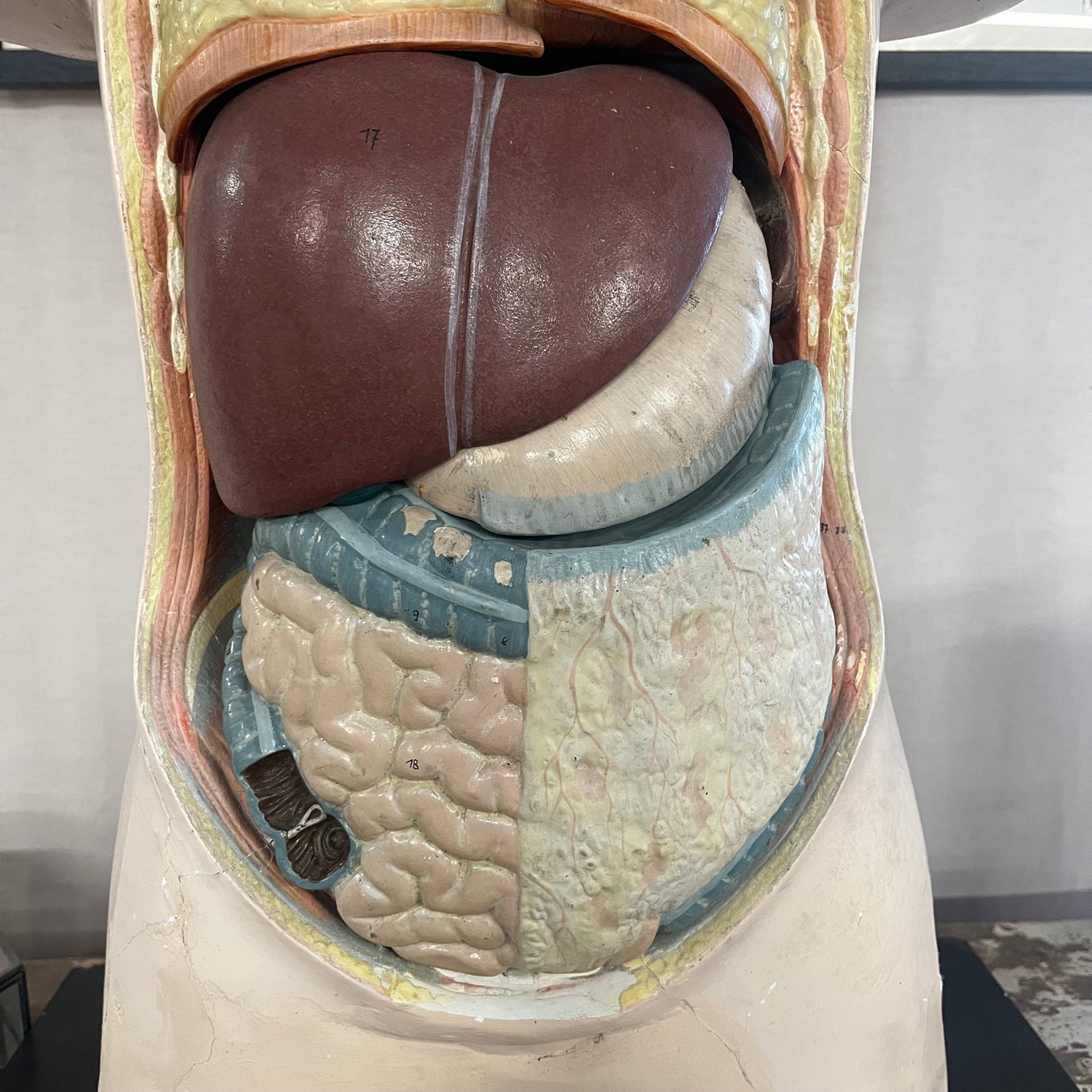 Ecorché Anatomique – L'Atelier du Cadre